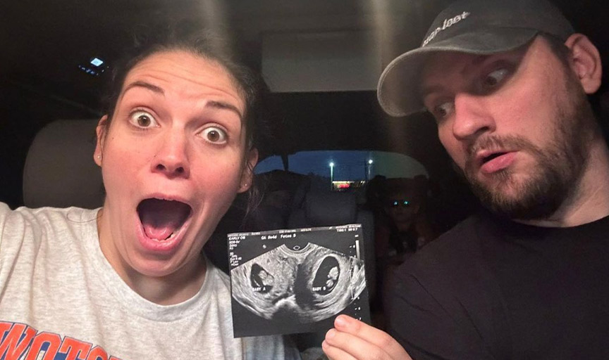 Woman born with two uteri expecting a child in both, a on...