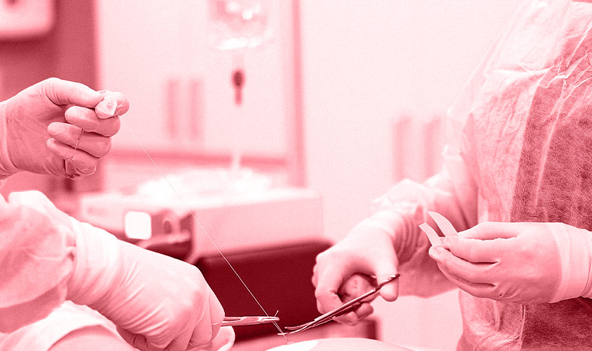 What is the husband stitch? Understanding the controversi...